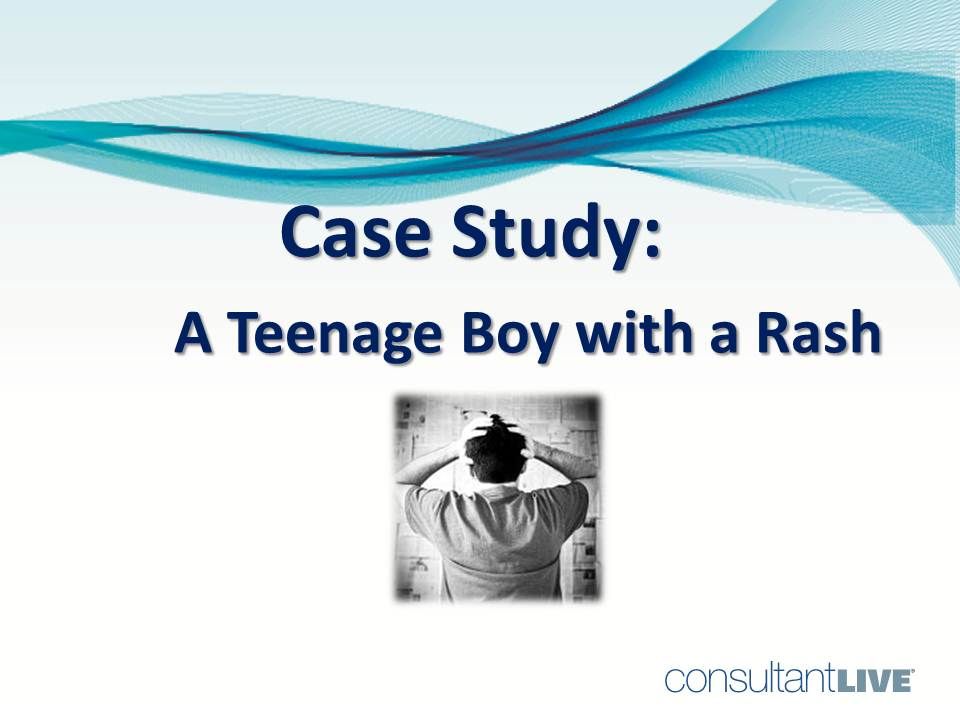 A Teenage Boy with an Unsightly Rash