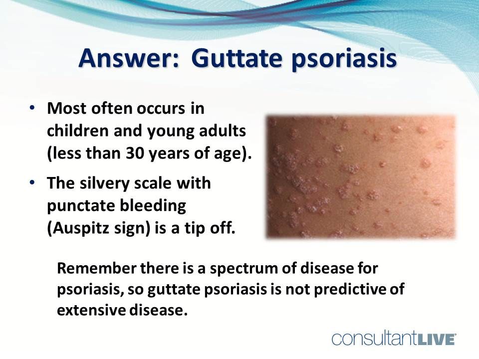 A Young Male with a Rash of Scales | Patient Care Online