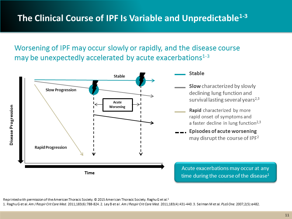 An Introduction to Idiopathic Pulmonary Fibrosis