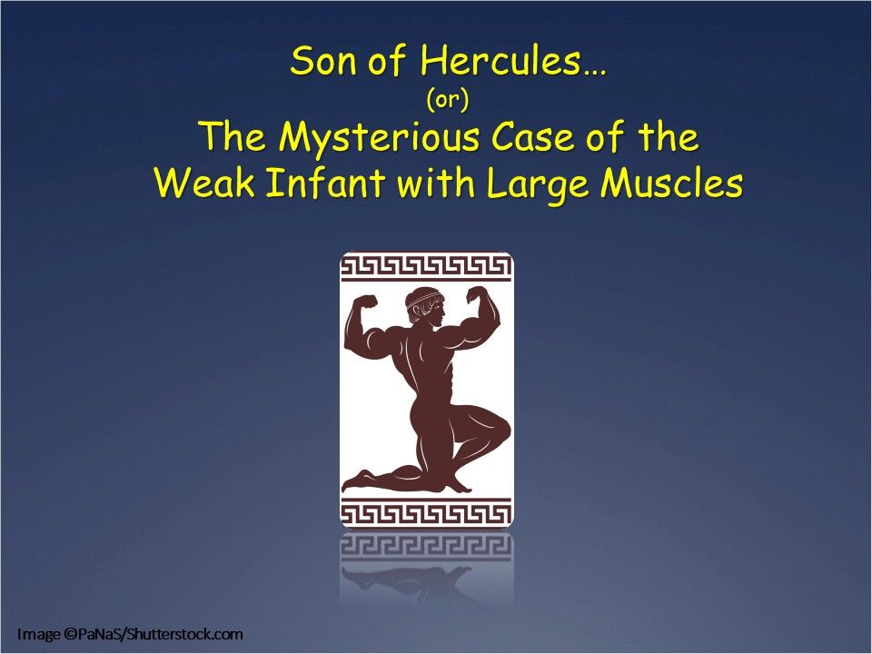 A Weak Infant with Large Muscles: What's Your Diagnosis? | Patient Care ...