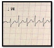 ECG Challenge: Weak and Faint