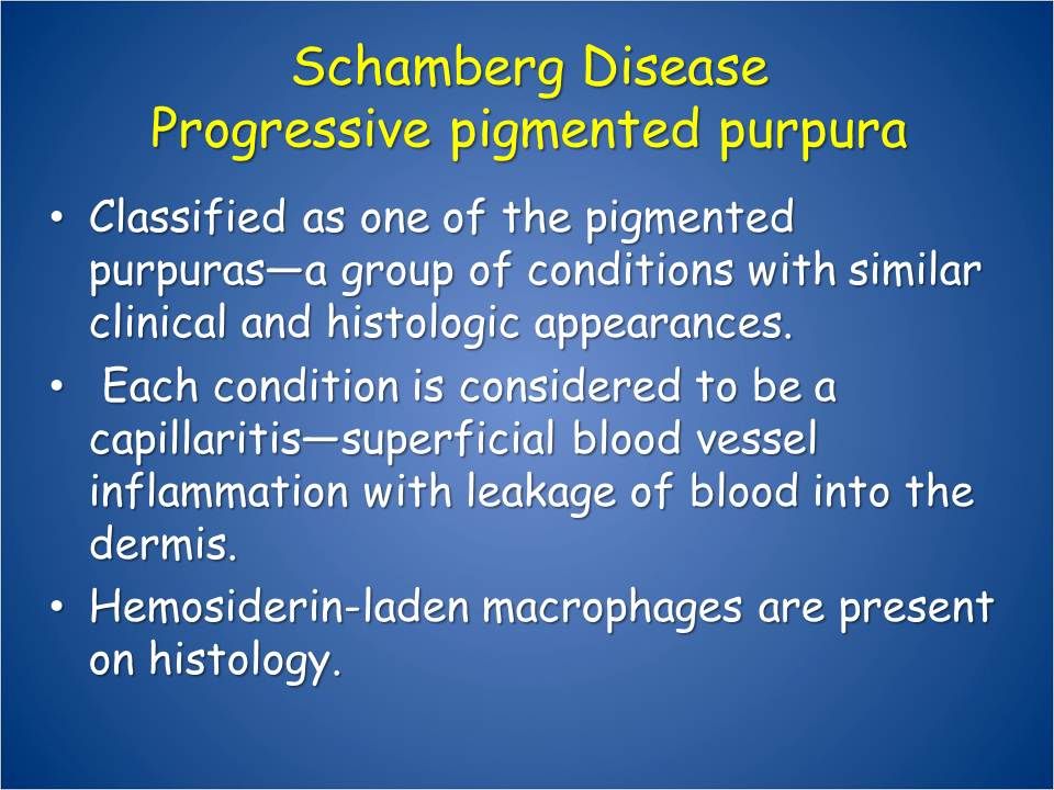 Puzzling Purpuras: Tale of an Unusual Bruise | Patient Care Online