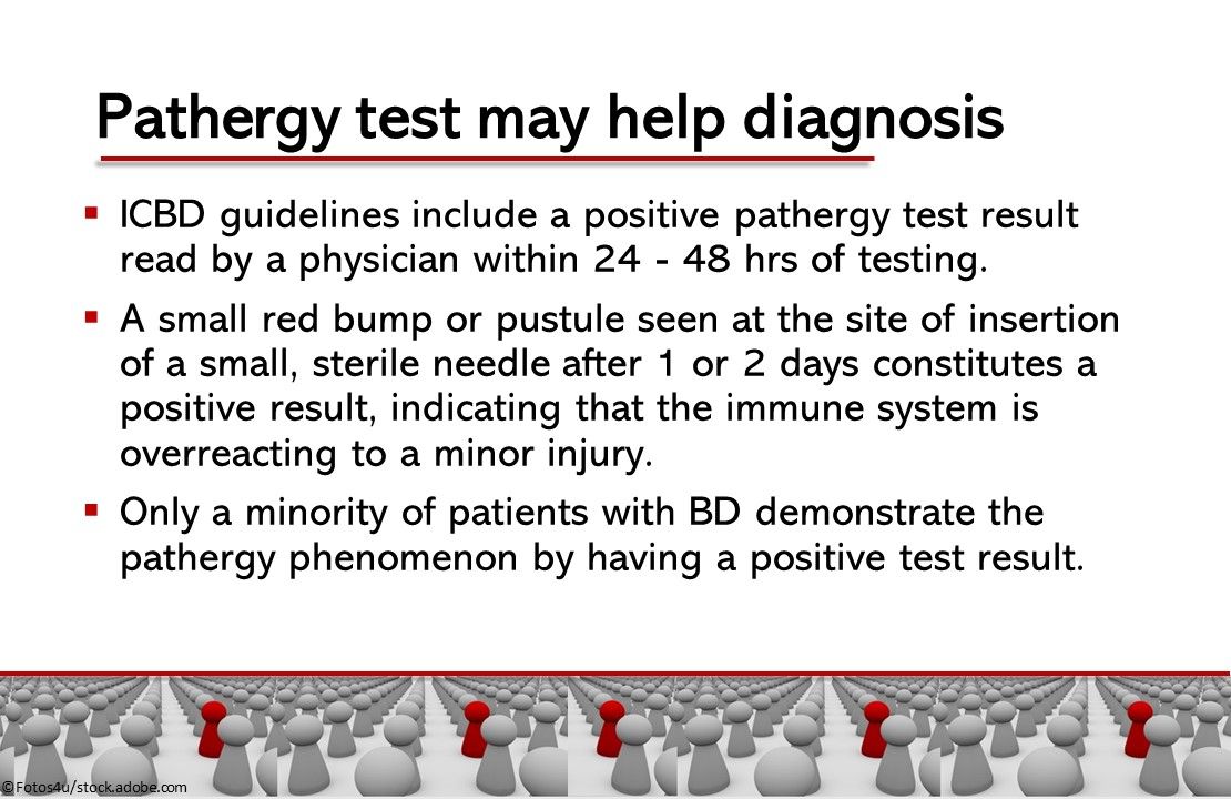 Behcet Basics for Primary Care: Diagnosis | Patient Care Online