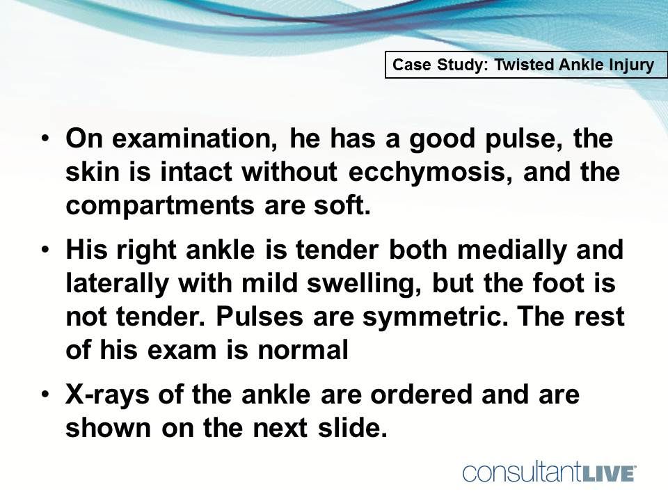 Ankle Injury: Can You Find the Twist? | Patient Care Online