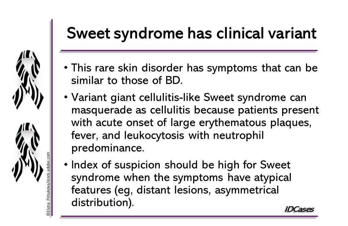 Rare Disease Update for Primary Care | Patient Care Online
