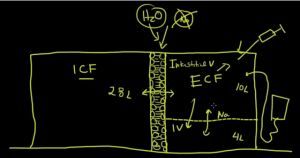Hyponatremia Explained Clearly