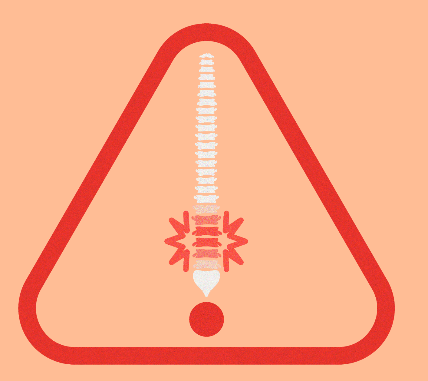 Help Patients Manage Low Back Pain, Risk Factors