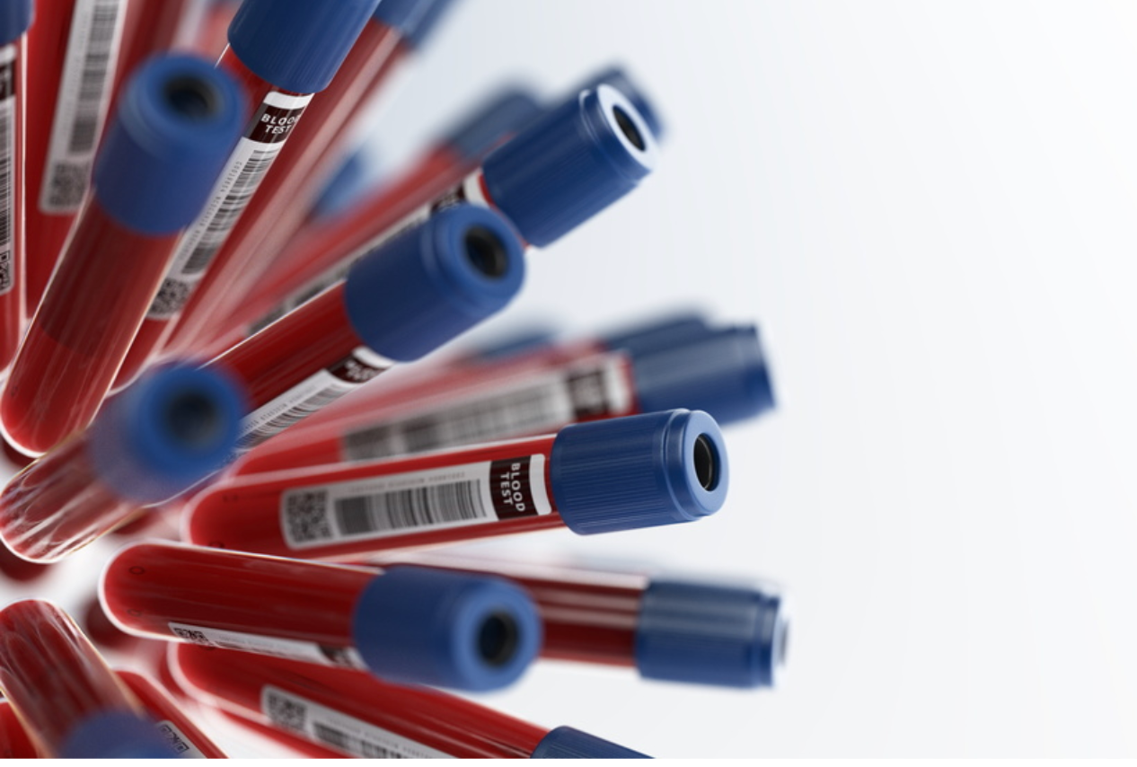 HIV Testing Frequency Among PrEP Users Lower Than Recommended