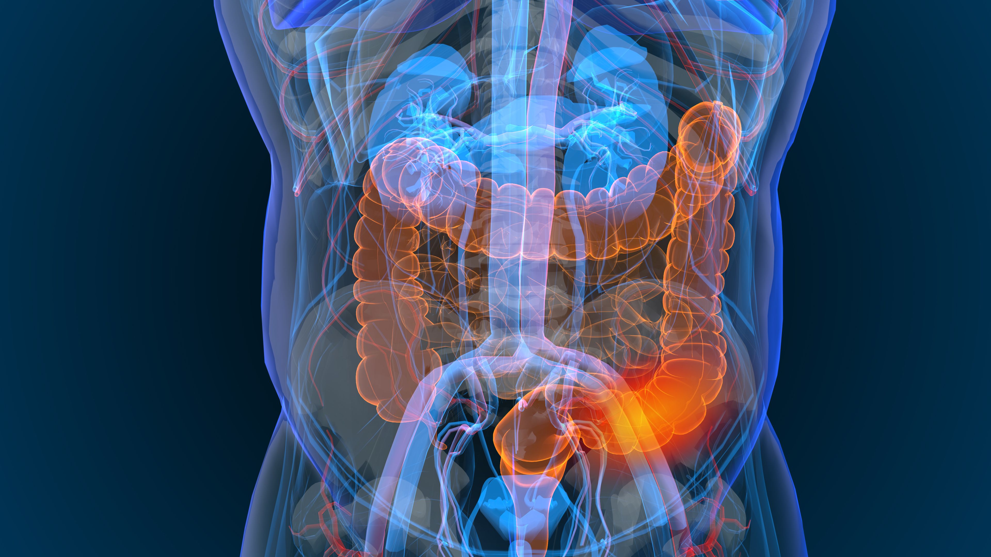 No Difference Observed Between Branded Biosimilar Enoxaparin For Post
