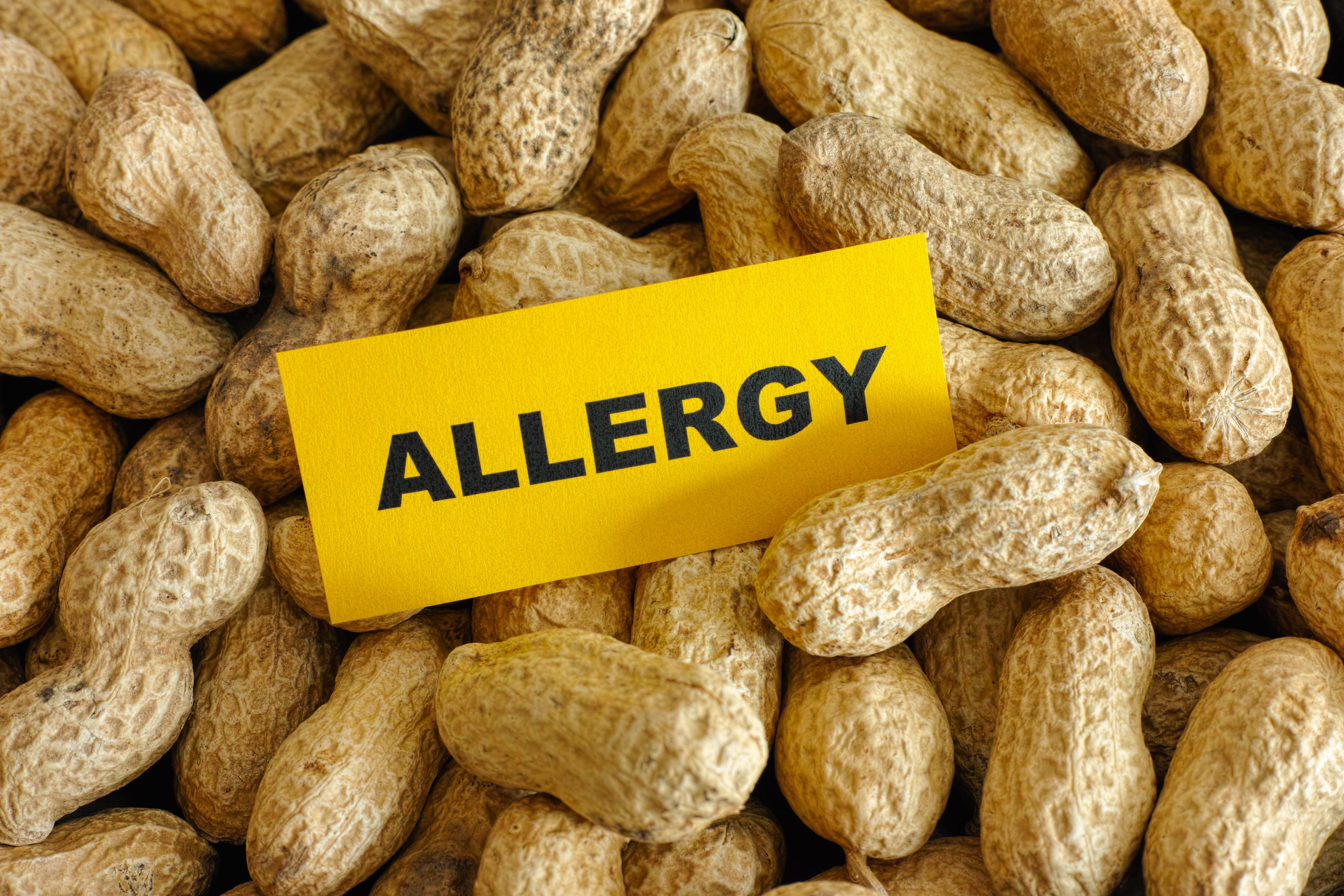 Early Peanut Introduction Deemed Safe to Prevent Allergy, Some Parents ...