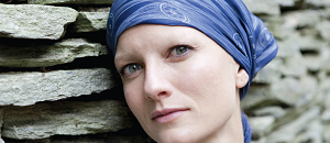 Hair Loss Due to Cancer Treatment