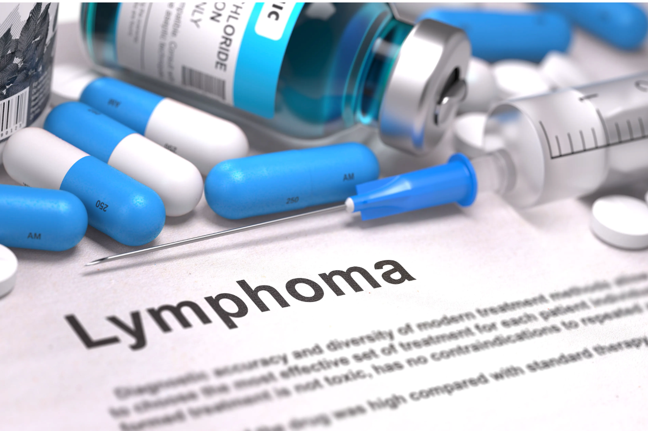 Epcoritamab Added to NCCN Guidelines for Fast-Growing B-cell Lymphomas