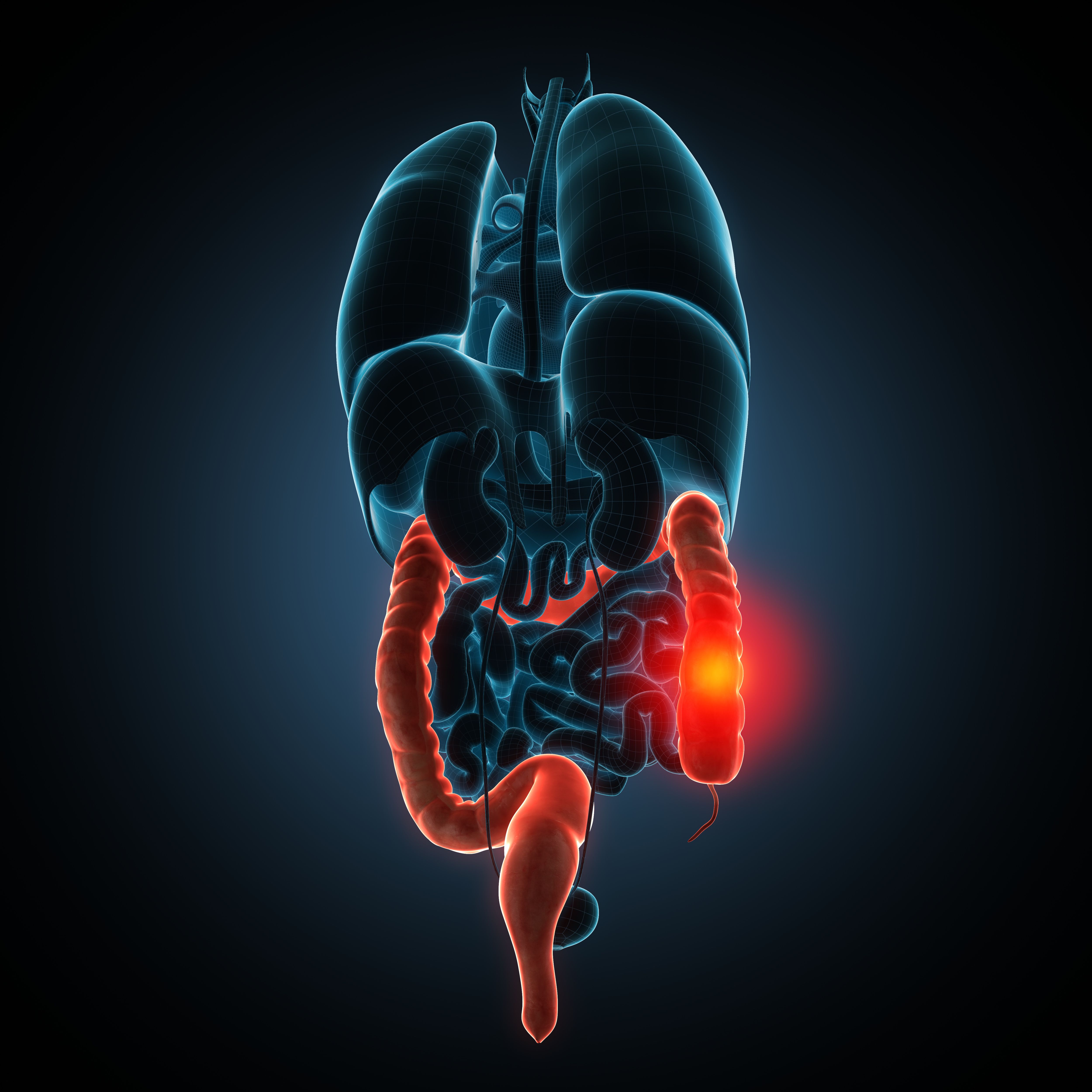 Combining Liver-directed Therapy With Systemic Therapy When Treating ...