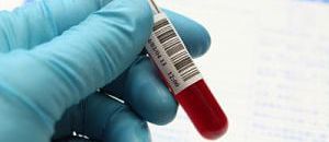 New Retrovirus Screening Test Launched by Roche