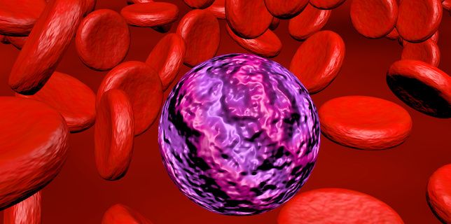 AML Genomic Landscape Plays Key Role in Treatment