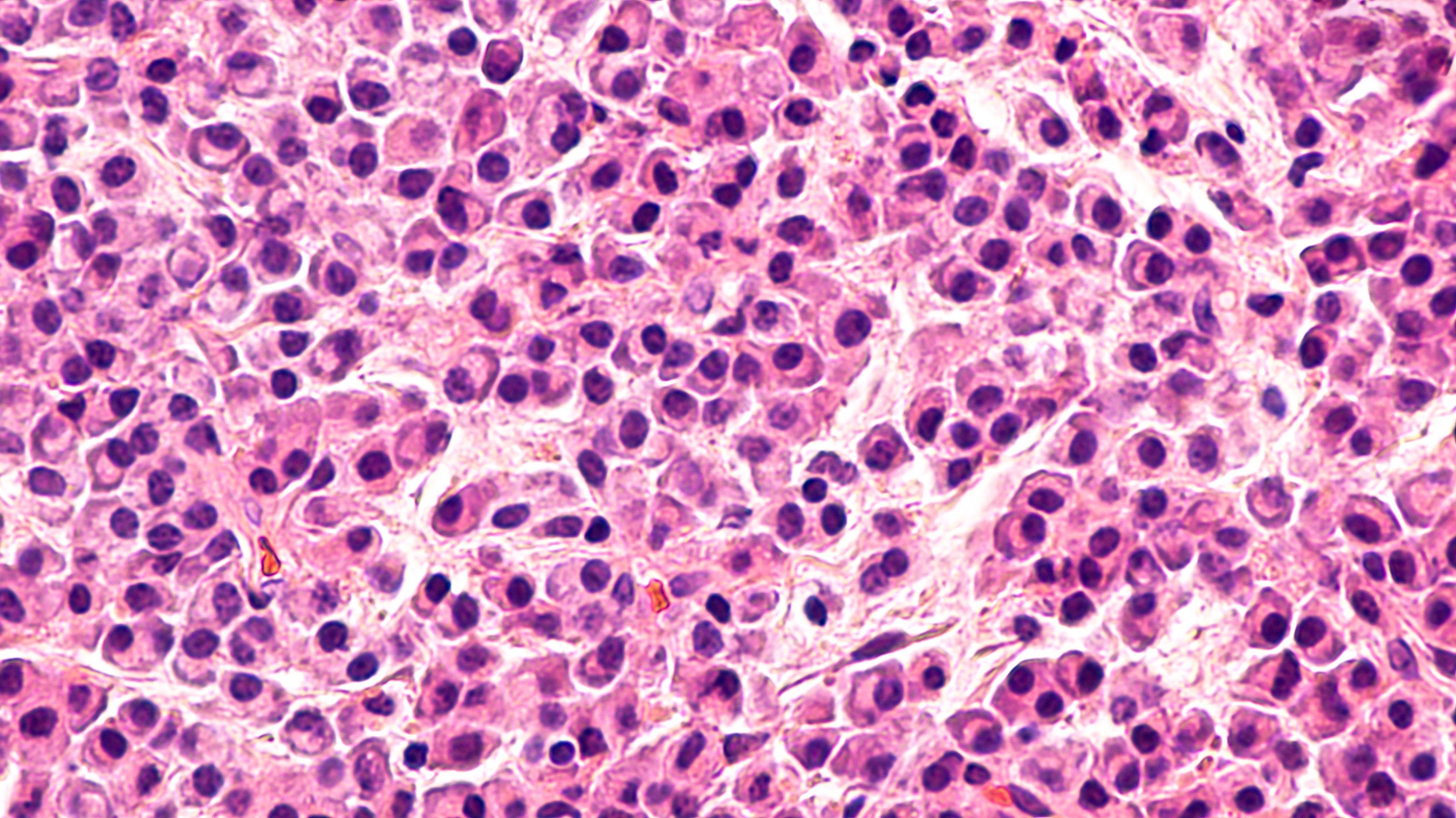 FDA Approves Teclistamab-cqyv as First Bispecific T-cell Engager ...