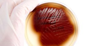 New Antibacterial Drug Avycaz Available to Order