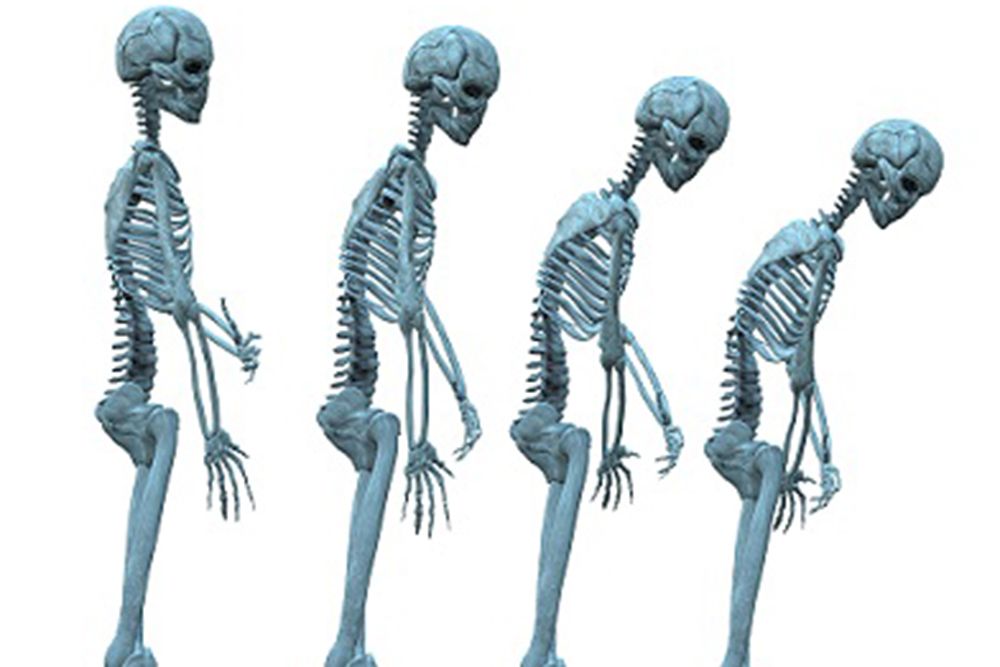 Managing bone health a practice-wide effort