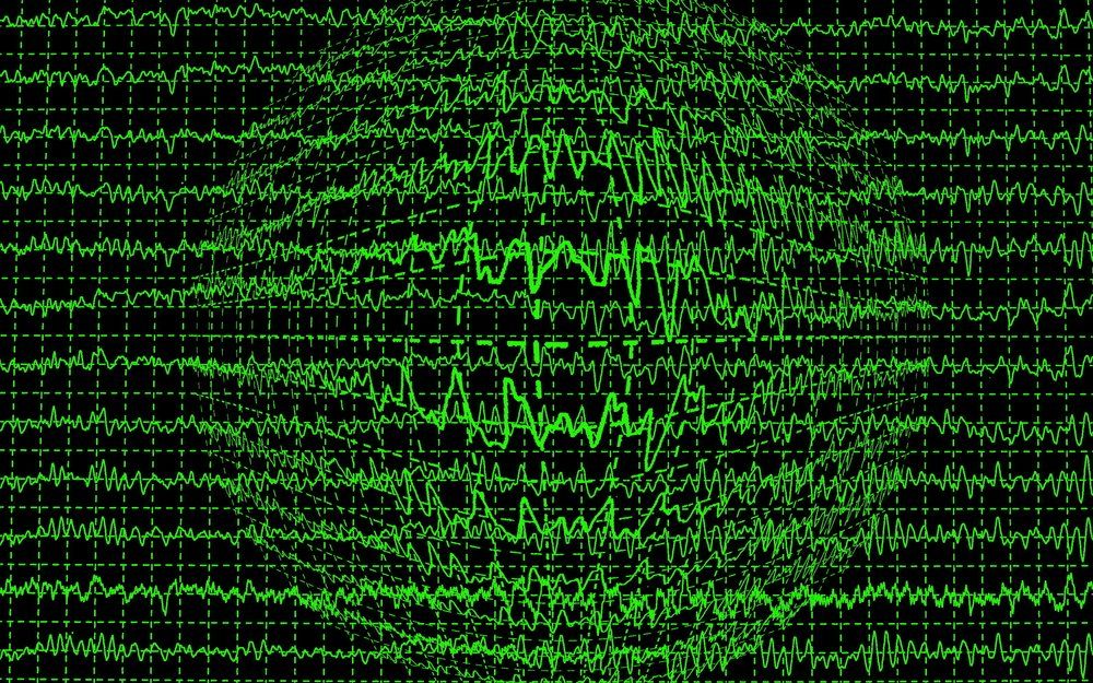 Who Diagnoses and Treats Epilepsy in Patients With Psychiatric Symptoms ...