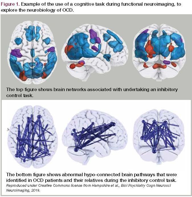 Exploring The Neurobiology Of Ocd
