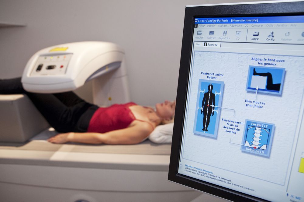 The Pros and Cons of DXA-What Are the Alternatives? | Rheumatology Live