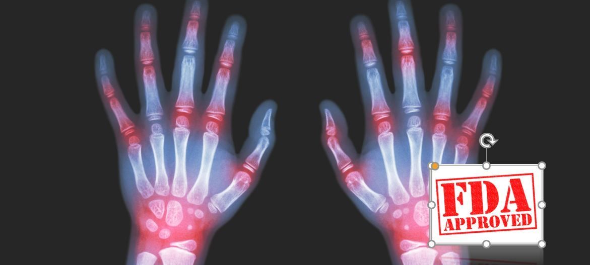 Tofacitinib Approved for Juvenile Arthritis | Rheumatology Live