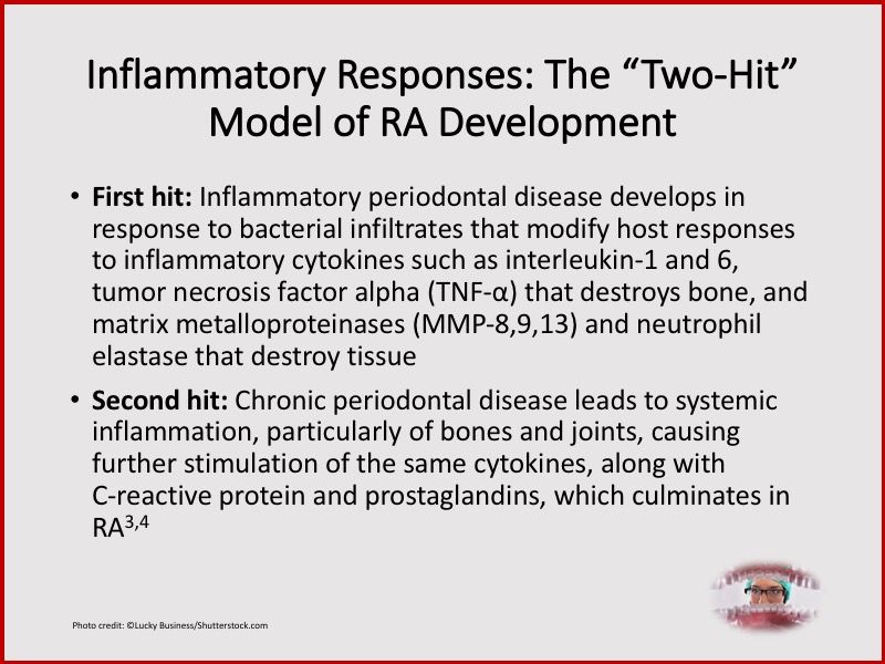 The Link Between Periodontal Disease And Rheumatoid Arthritis