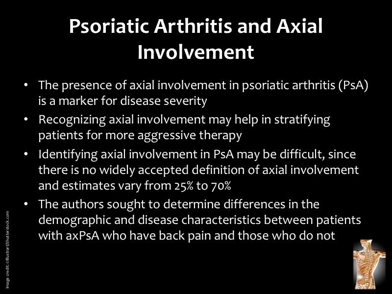 How Best to Assess Axial Involvement in Psoriatic Arthritis?