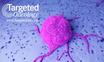 NeoALTTO TIL Analysis Shows EFS, OS Association in HER2+ Breast Cancer