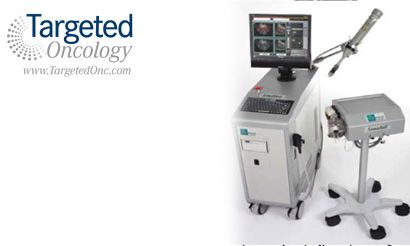 Prostate Surgery To Be Done With High-Intensity Ultrasound Device