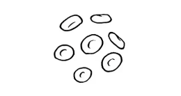 T-Cell Redirection Therapy Shows Promise As Salvage Therapy in R/R ...