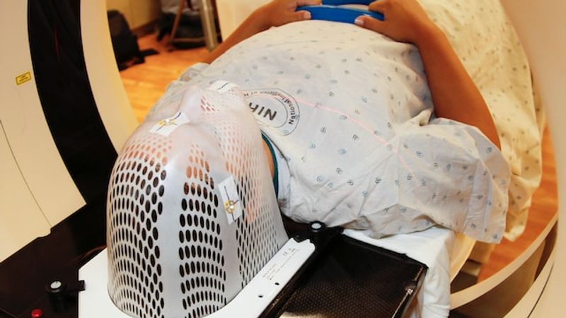 Amazing people who became gifted and genius after brain injury | Sugar.mn