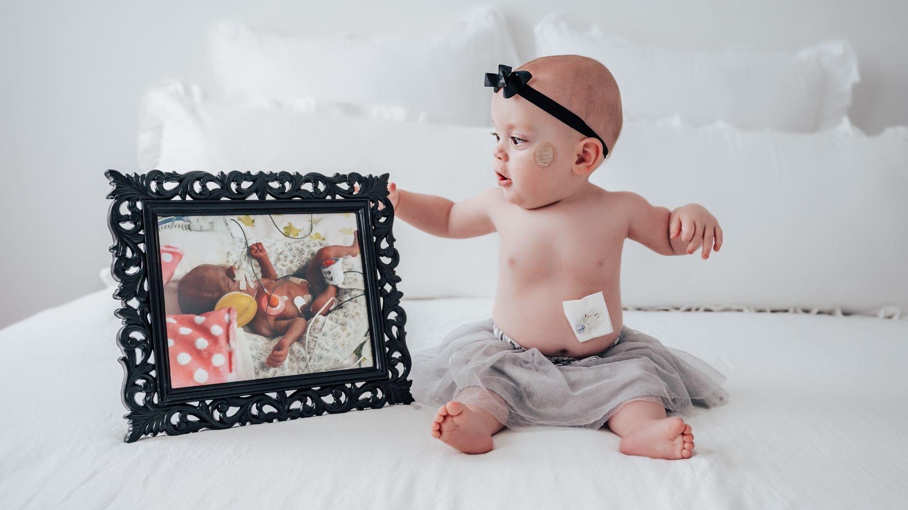 A Fighting Chance at 24 Weeks: Sloan's Story | Renown Health