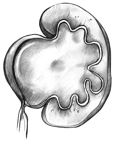 Dr G N Sahoo - Leading Laparoscopic and Cancer Surgeon in Bokaro