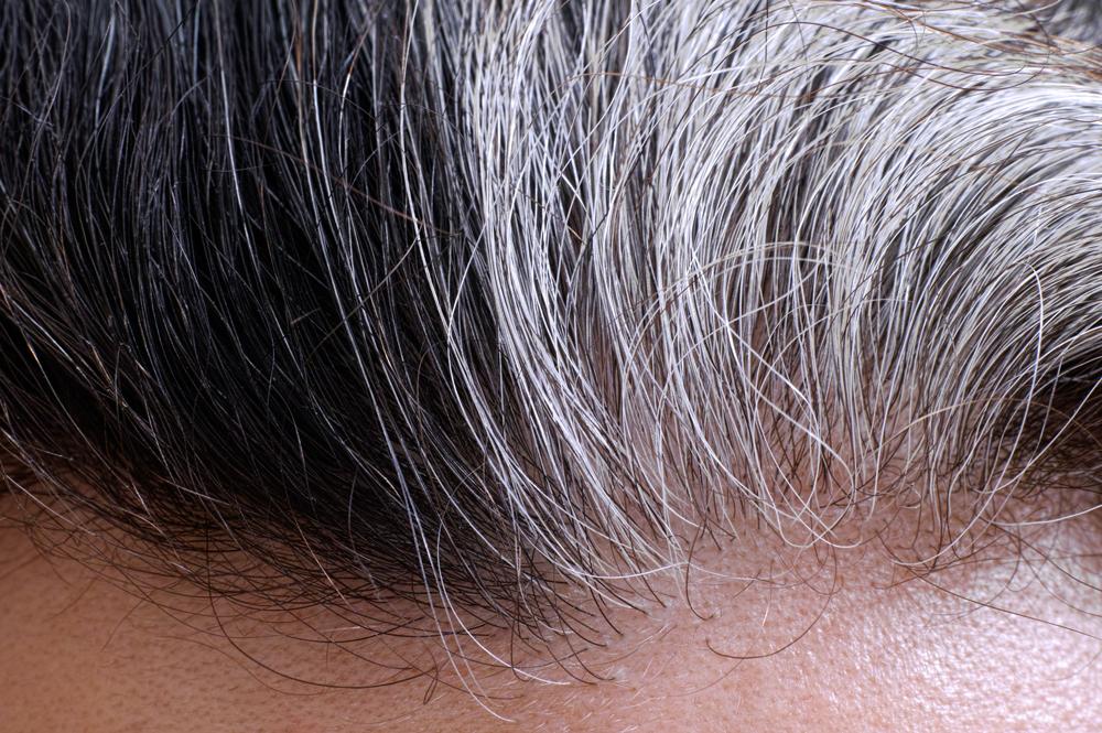 Scalp anatomy: the 5 layers of the scalp - XYON Scalp anatomy: the 5 layers of the scalp - XYON