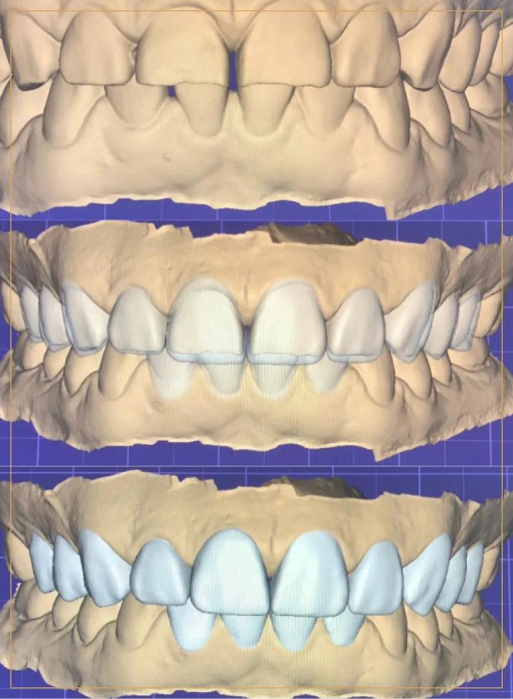 Utilizing the latest in dental technology for best outcomes