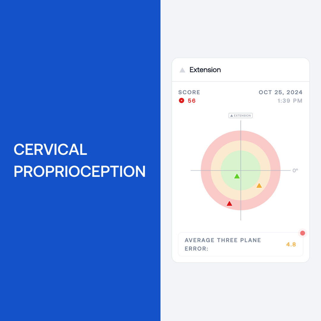 What is cervical proprioception? What is cervical proprioception?