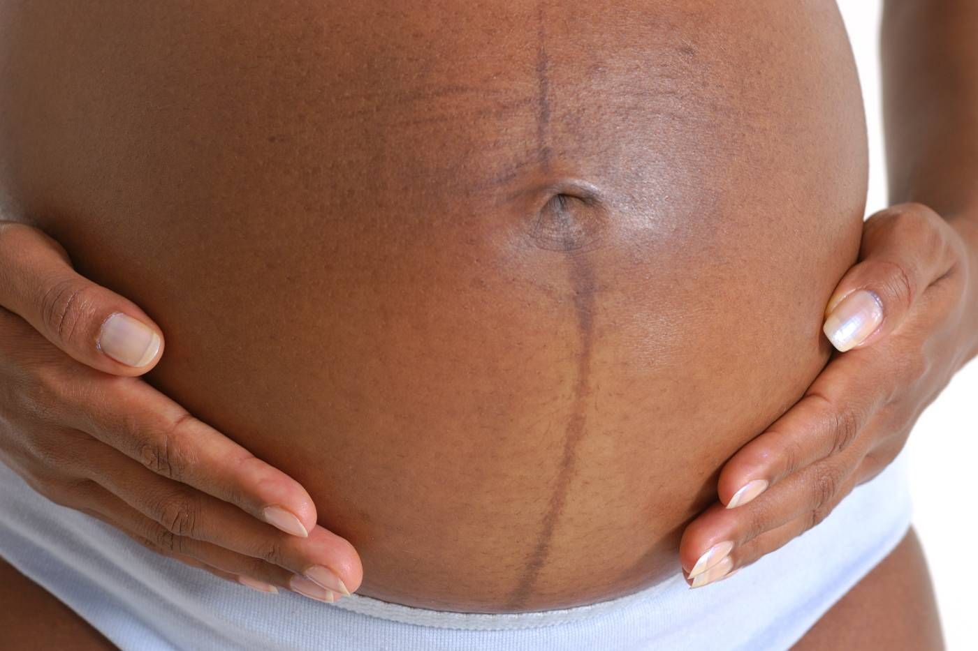 Linea Nigra: Line on Pregnancy Belly, Explained