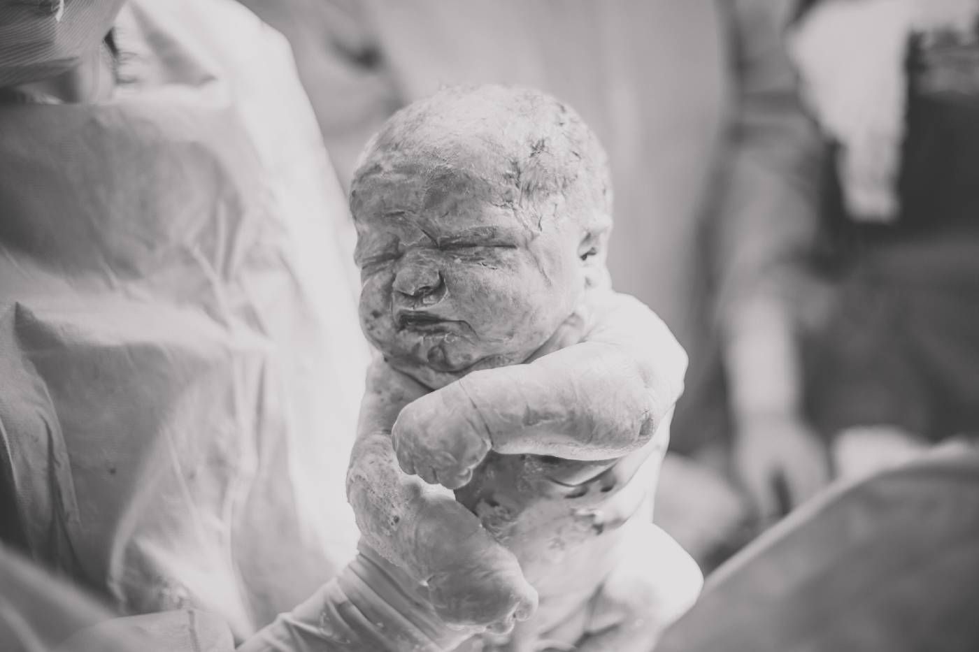 Vernix: What You Need to Know