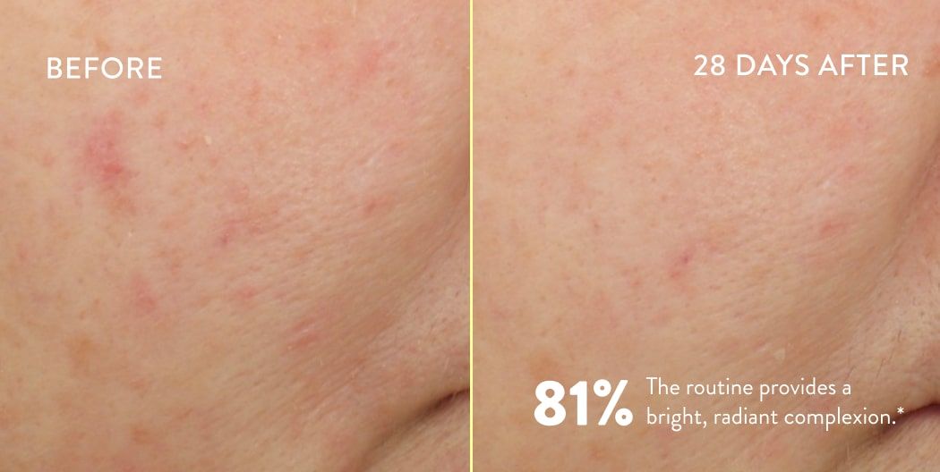 Skin Damage: Causes, Prevention & Treatments | PROVEN