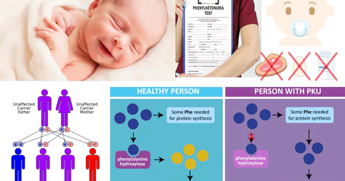 Phenylketonuria (PKU) Screening for a Newborn