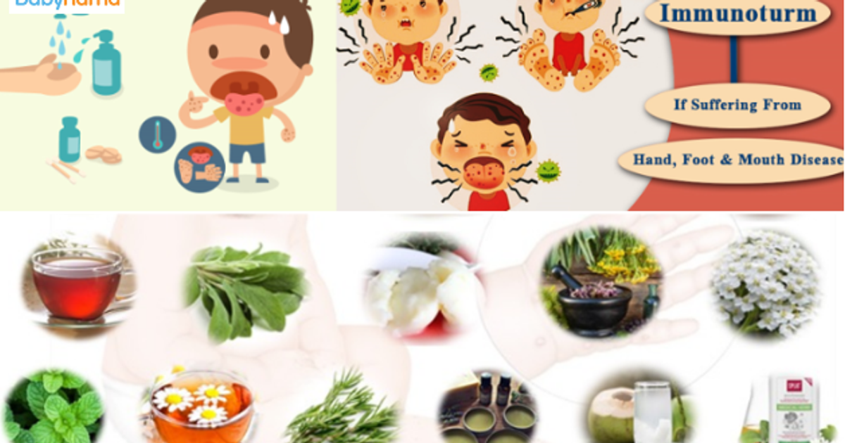 Home Remedies for Hand, Foot, & Mouth Disease (HFMD)