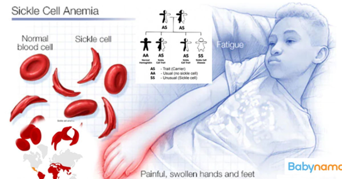 Sickle Cell Disease in Children: A Parent's Guide