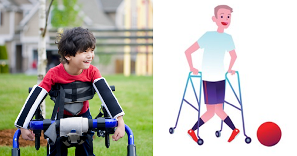 Cerebral Palsy & Birth Defects: Causes & Risk Factors