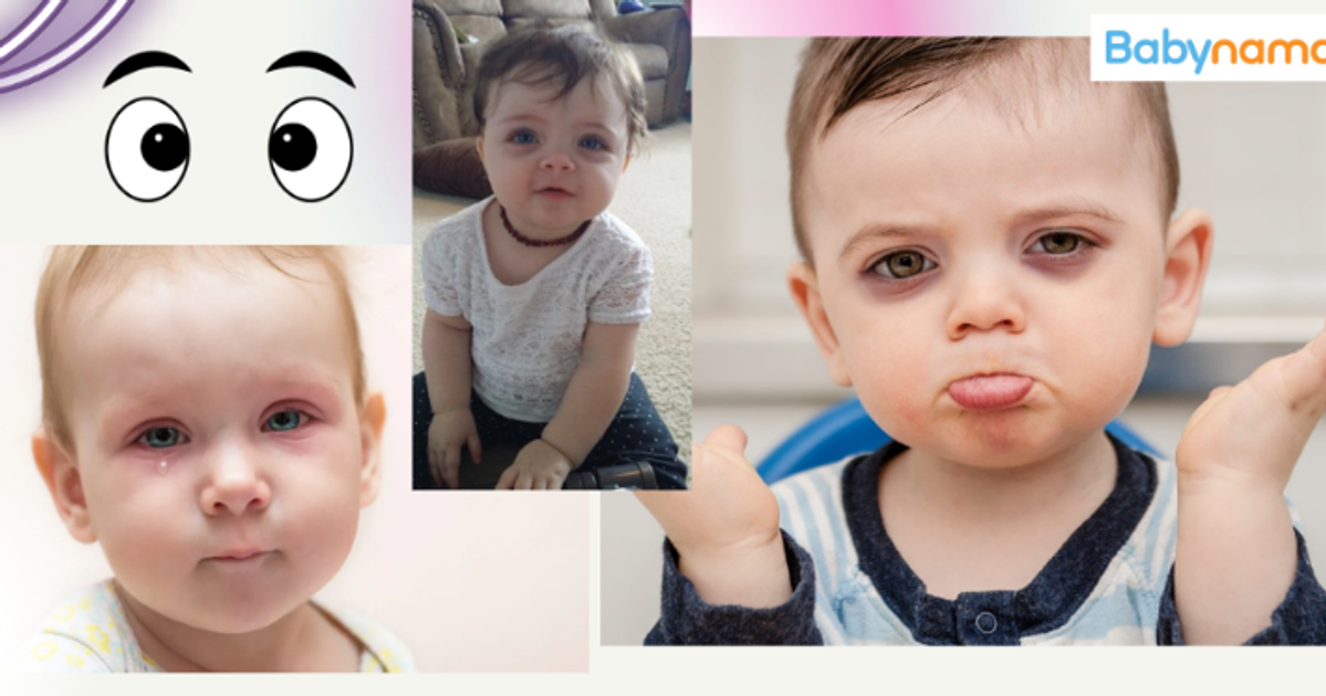 Dark Circles Under Your Baby's Eyes: Causes & When to Worry