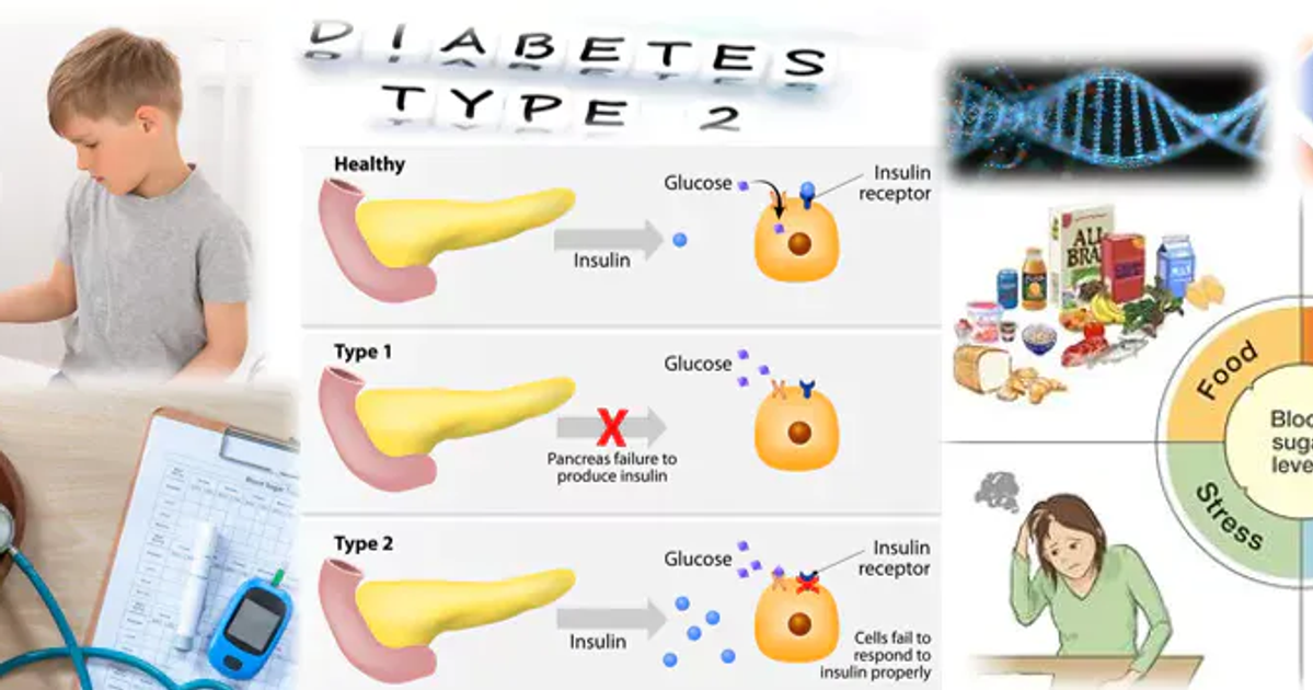Type 2 diabetes in kids