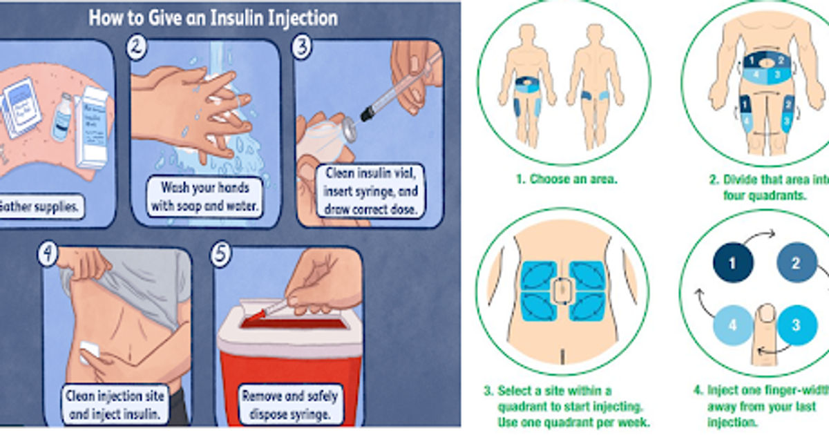Insulin Injections for Kids: Type 1 Diabetes Guide