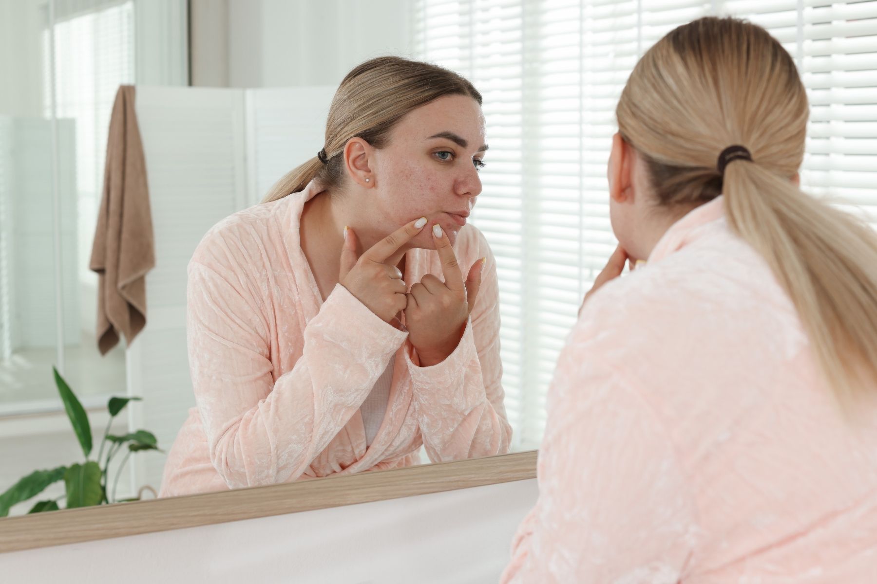 Period Acne: Why Pimples Appear & How to Stop Breakouts | Samphire ...