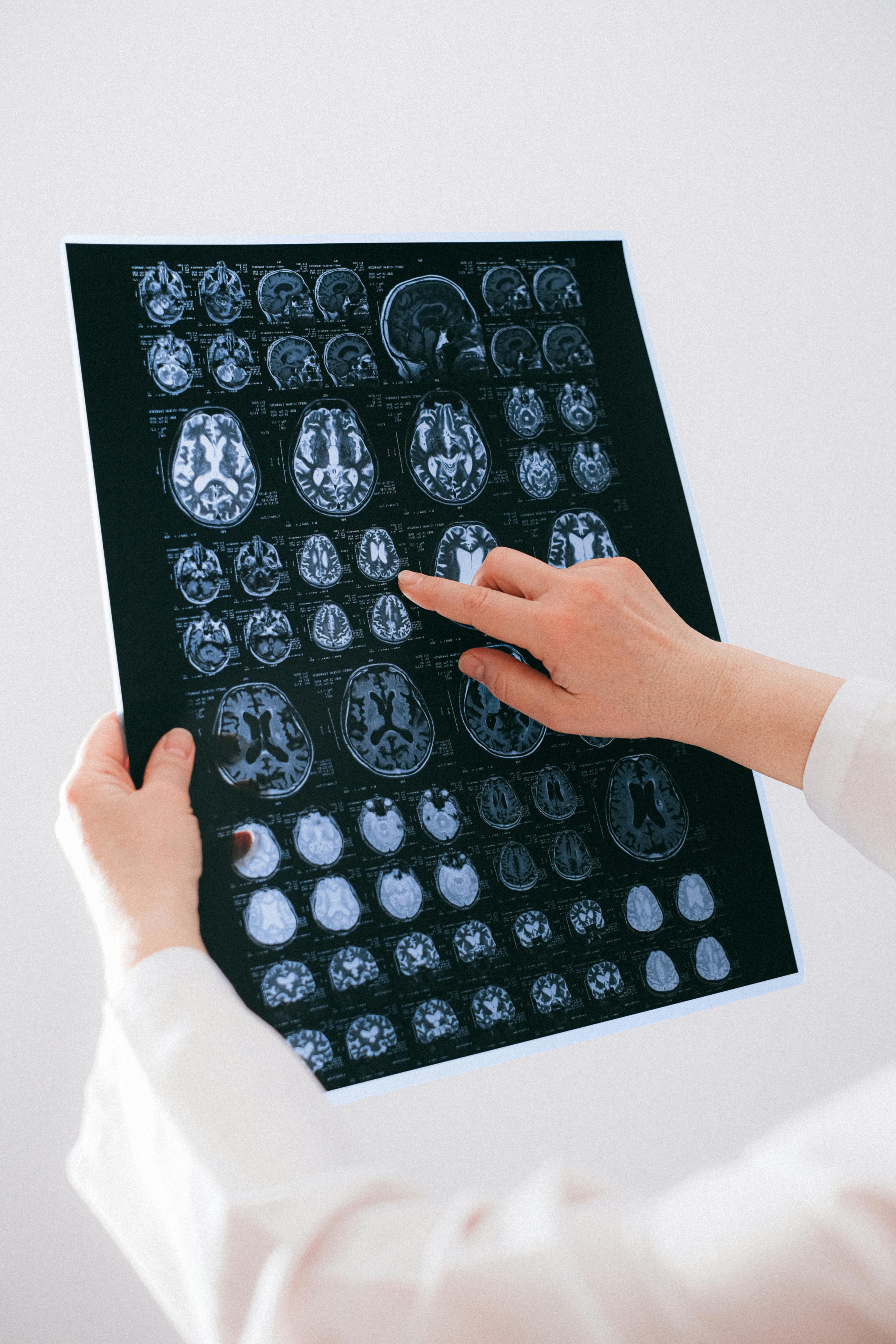 How the Menstrual Cycle Changes Brain Insulin Sensitivity | Samphire ...