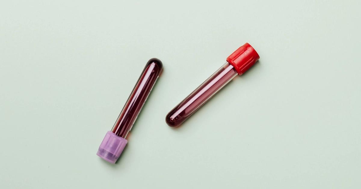 Ivee Which Blood Test Do I Need To Fast For ivee-which-blood-test-do-i-need-to-fast-for